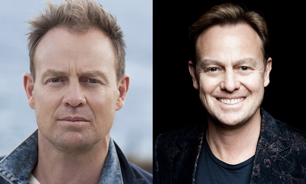 Celebrities With Hair Transplant- AJ McLean, Steve Carell etc ...